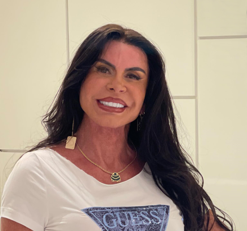 Gretchen choca com novo rosto após procedimentos estéticos: “Tá ...