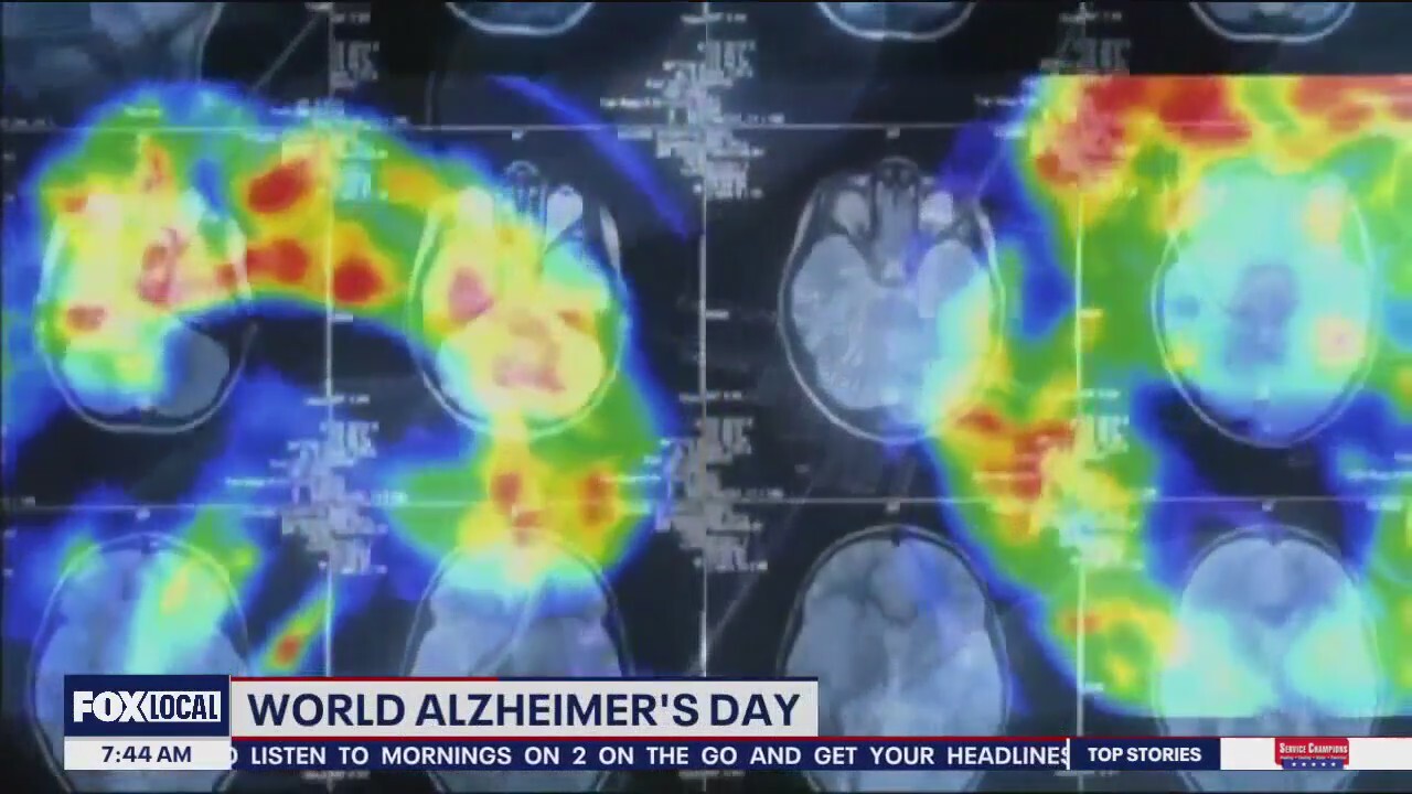 Author of "Future of Alzheimers" book shares research on managing ...
