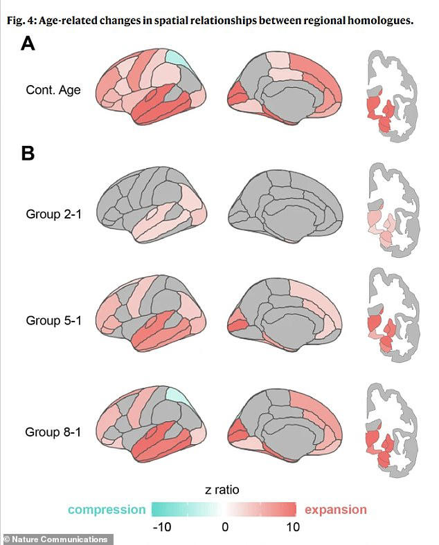 The shape of your brain could predict if you will develop dementia ...