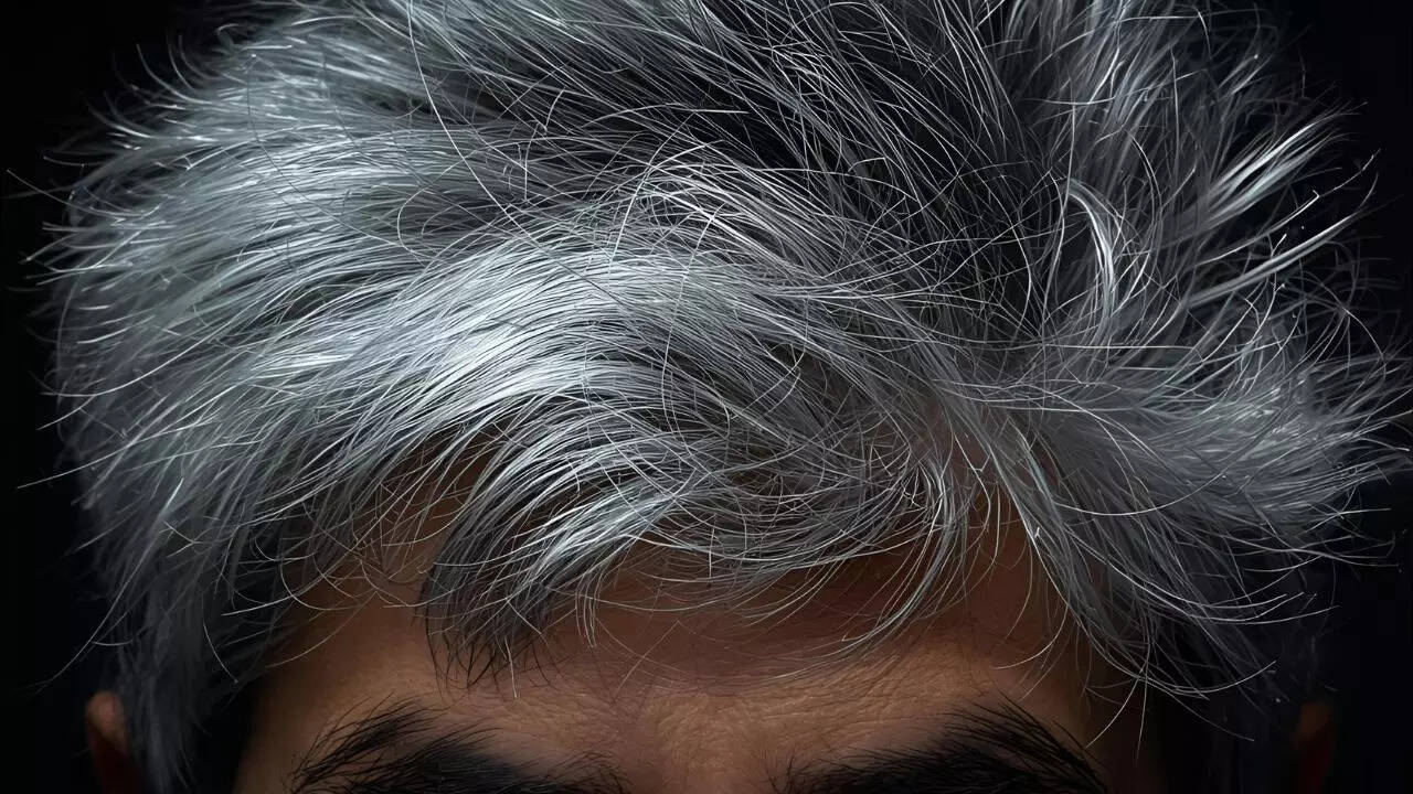 Your grey hair might be a warning sign of this vitamin deficiency