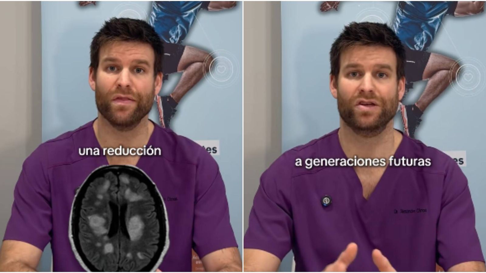 Alexandre Olmos, médico, sobre el daño que el alcohol hace al cerebro ...