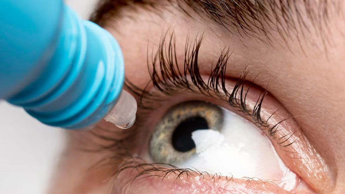 Monsoon Maladies: Your One Simple Fix for Chronic Dry Eyes, Says Expert
