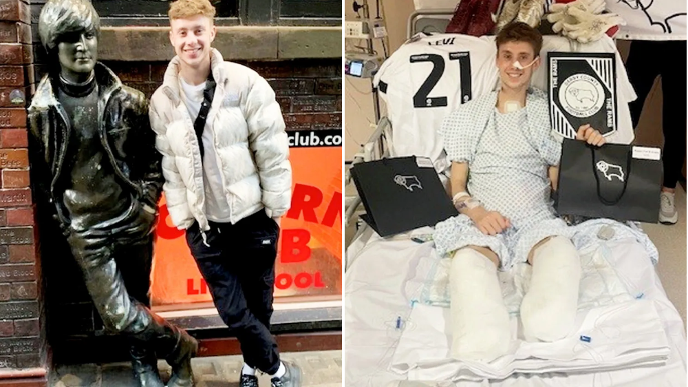 Young man loses both legs to sepsis after flu symptoms
