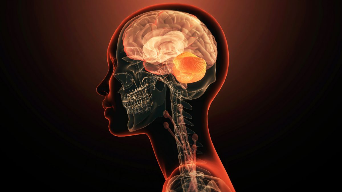 What inflammation does to your brain – and how to reduce the impact