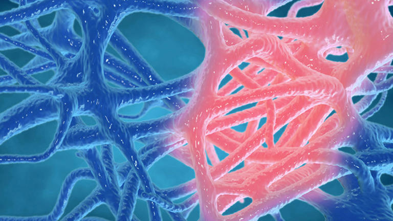 How Omega-3 Fights Inflammation Naturally: Expert Shares Benefits and ...
