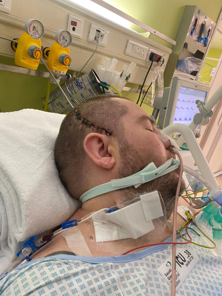 Man left unable to walk or talk after headache turned out to be a ...