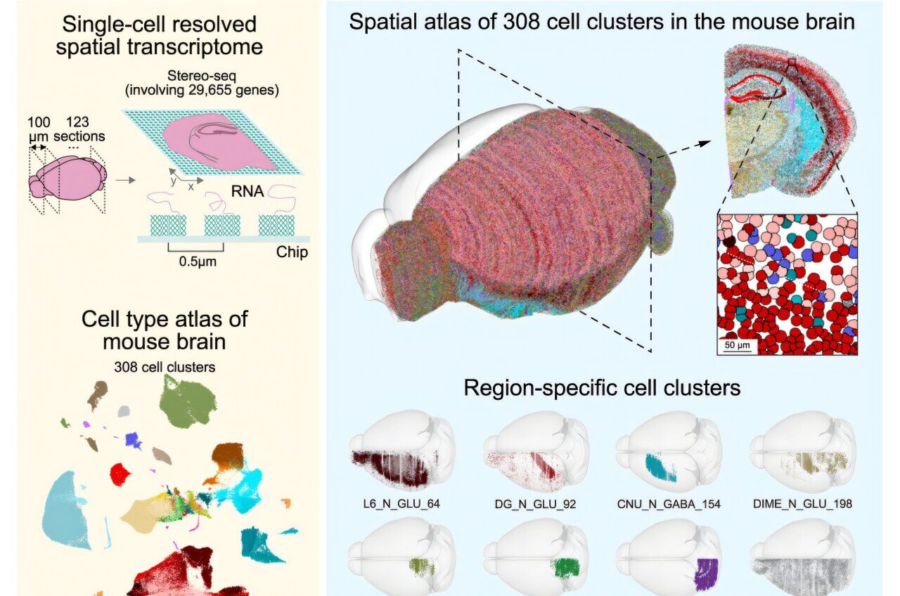 Study uncovers brain pathways connected to Alzheimer's memory loss and ...