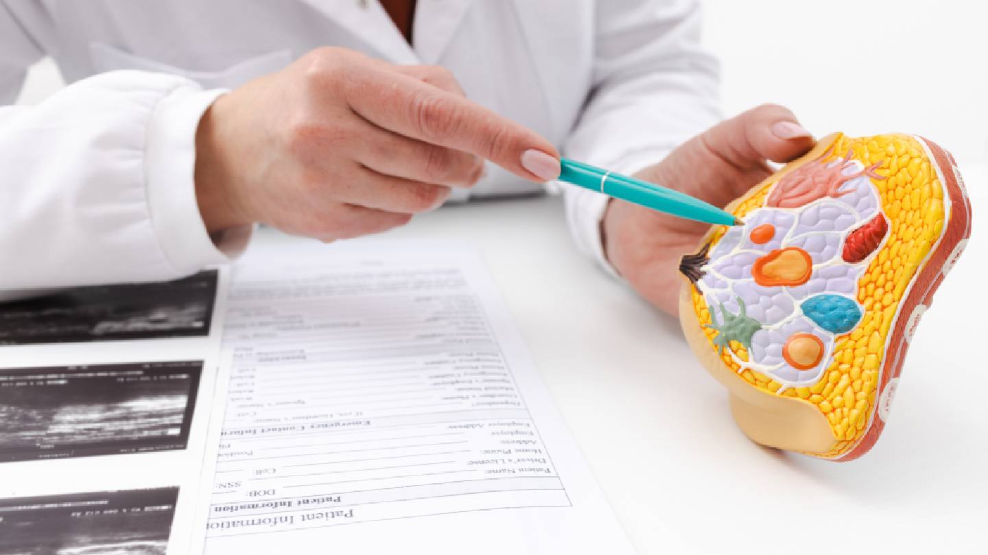 FDA approves IceCure’s ProSense system for breast cancer