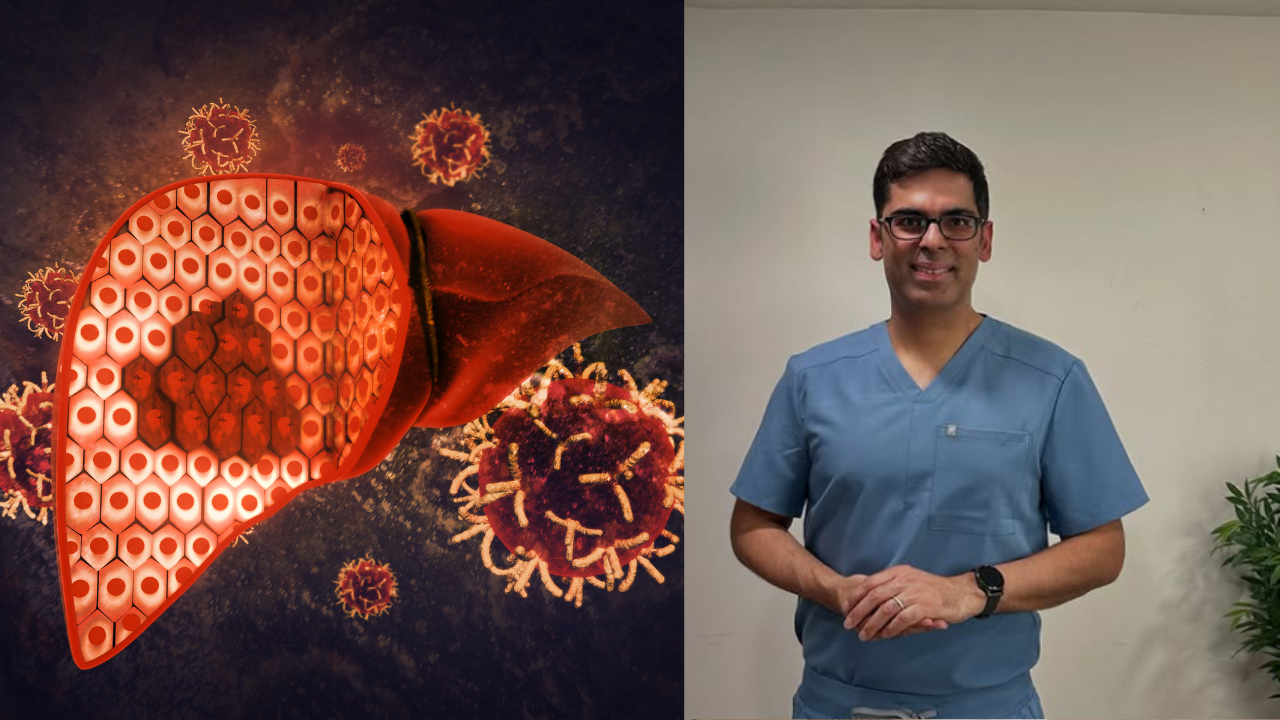 Doctor suggests 5 signs of fatty liver one can check at home