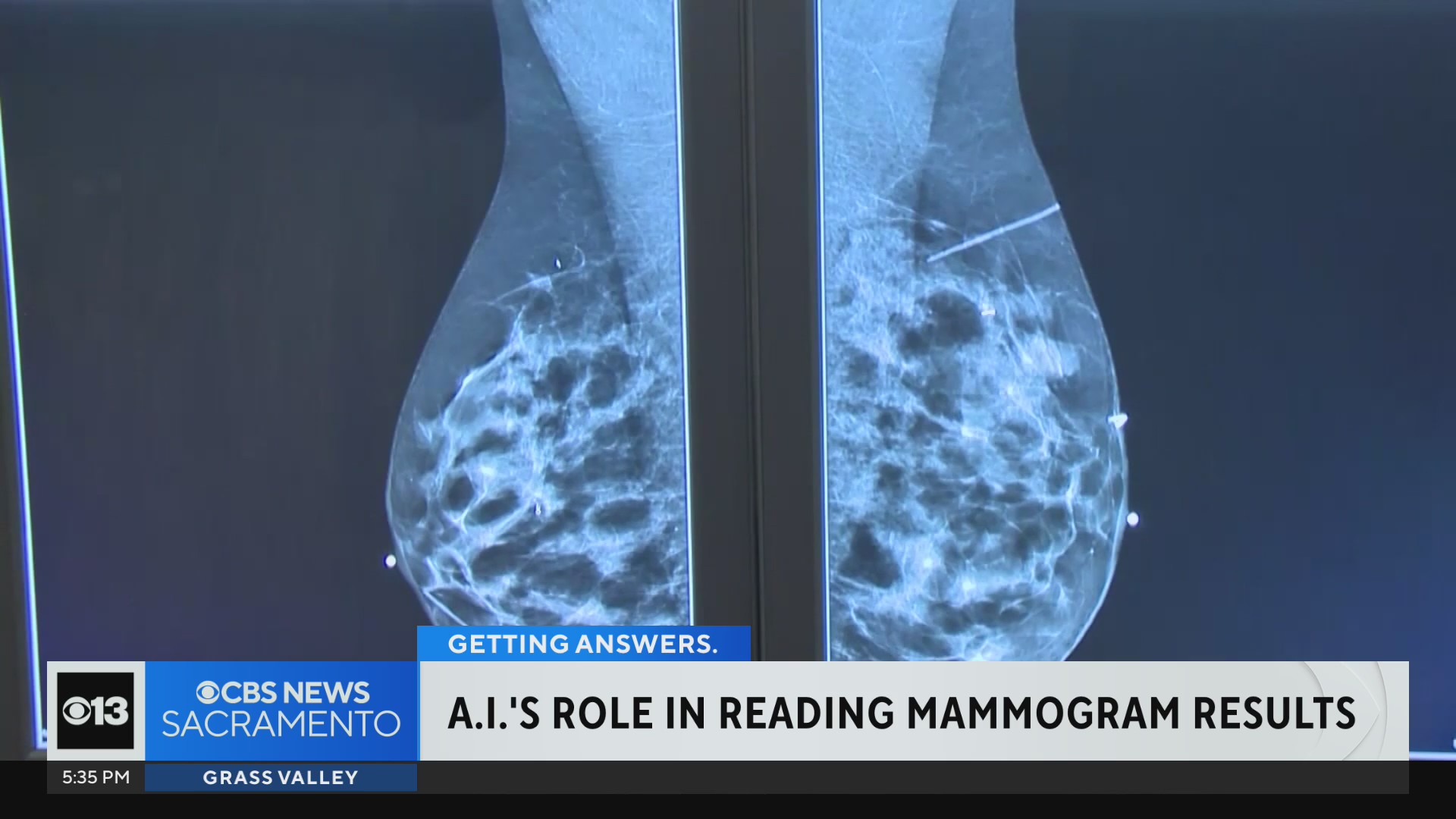 UC Davis to co-lead $16 million study axamining AI's role in reading ...