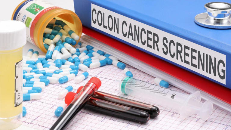 Un estudio español abre una nueva vía contra el cáncer colorrectal ...