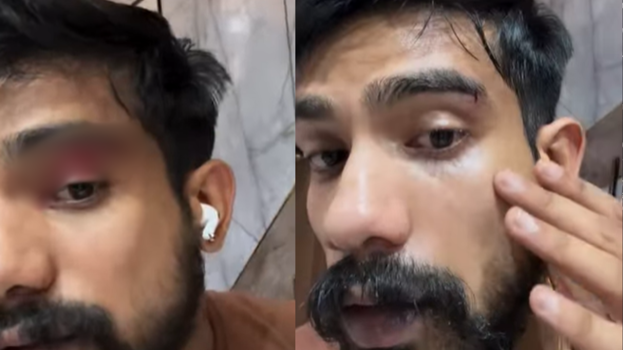 ‘Left Me Bleeding’: Here’s The Online Delivered Food Item That Left ...