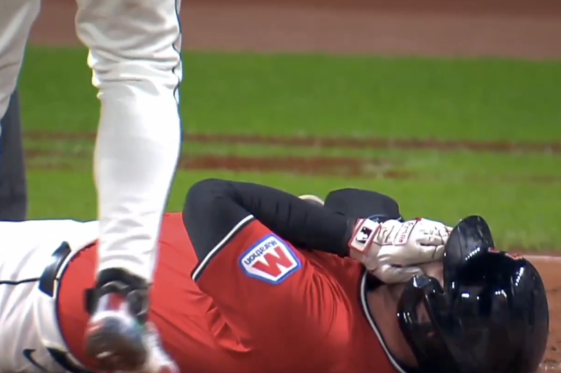 Cleveland Guardians star David Fry takes vicious pitch to face and is ...