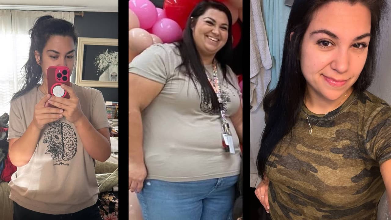78 Kg वेट लॉस करने वाली महिला थी ऑटोइम्यून बीमारी से परेशान, फिर सिंपल ...