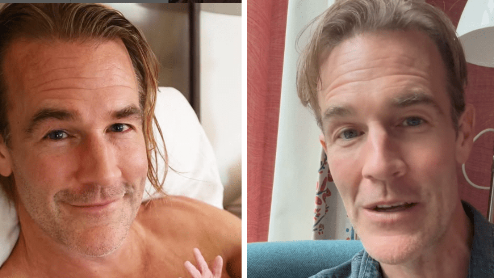 James Van Der Beek's Illness Has Drastically Changed His Appearance: 10 ...