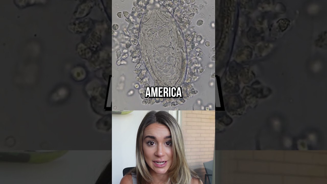 How snails can pose serious risks to human health