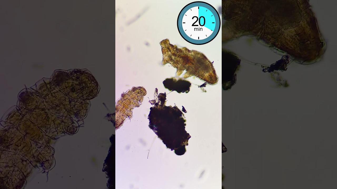 Can an $85 Digital Microscope Reveal Water Bears?