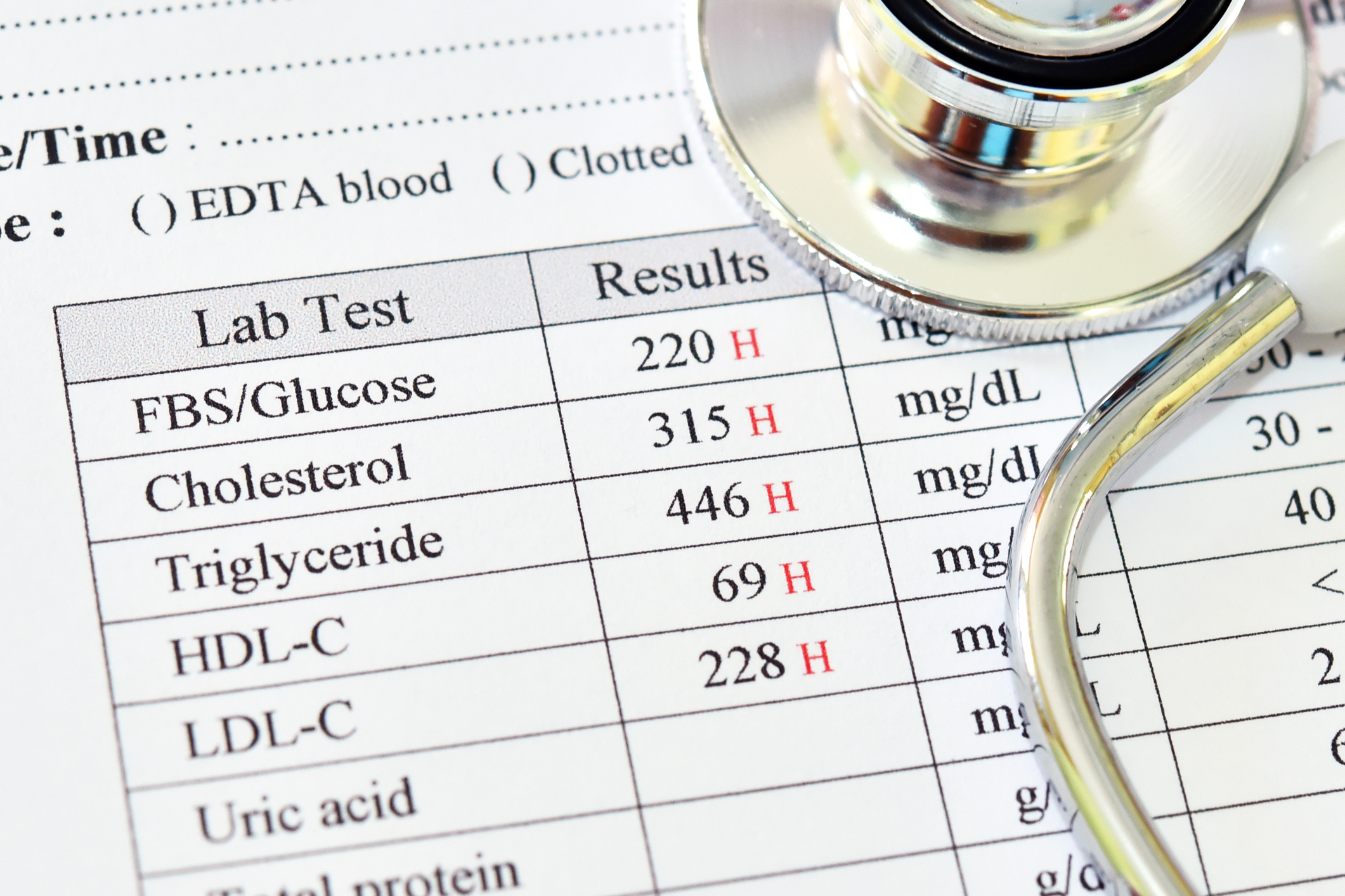 Mayo Clinic Q&A: Know your cholesterol numbers
