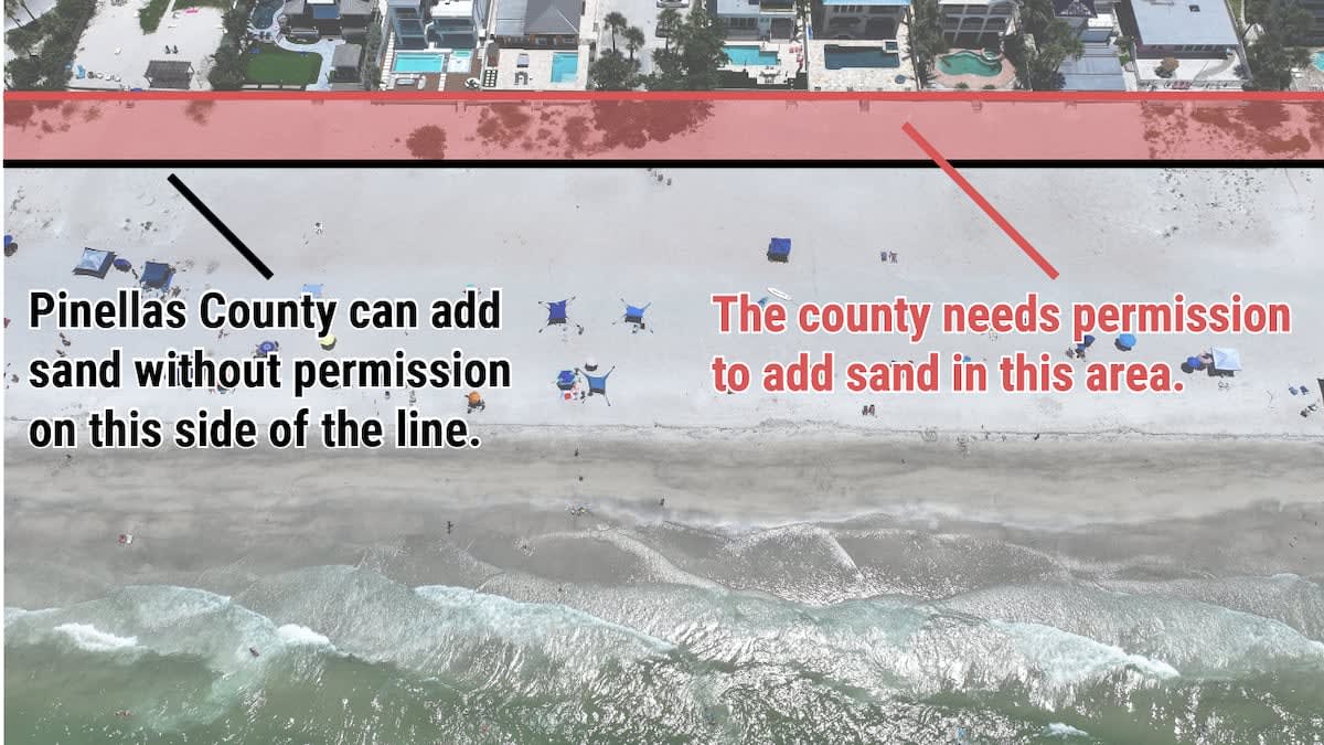 ‘Sawtooth’ Pinellas beach renourishment could leave some homes at risk