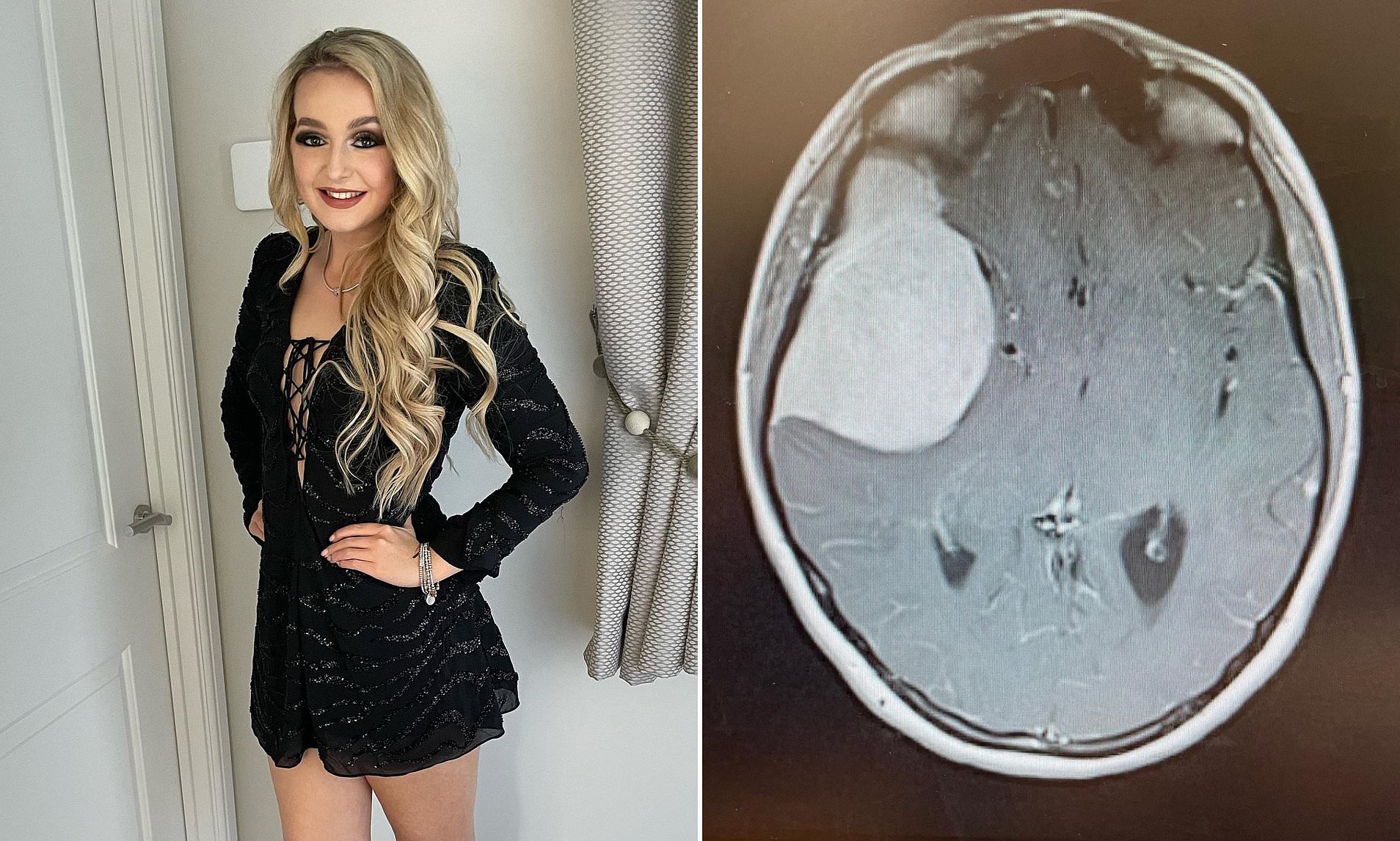 Woman, 26, diagnosed with brain tumour after she was fobbed off by GP