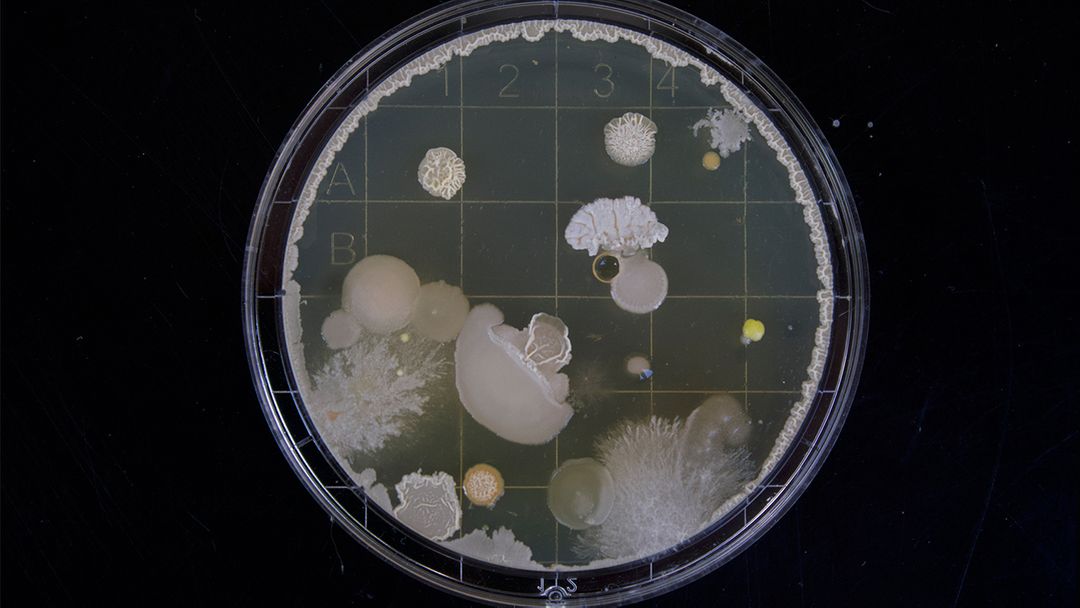 Scientists Have Discovered a Plastic-Eating Bacteria