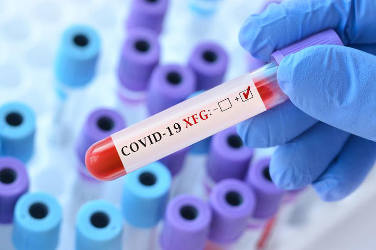 Pharmacist shares how long new 'Stratus' Covid lasts as symptom alert ...