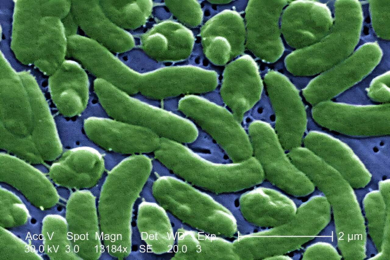 Global study maps spread of potentially dangerous Vibrio vulnificus in ...
