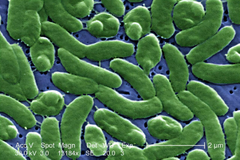 Global study maps spread of potentially dangerous Vibrio vulnificus in ...