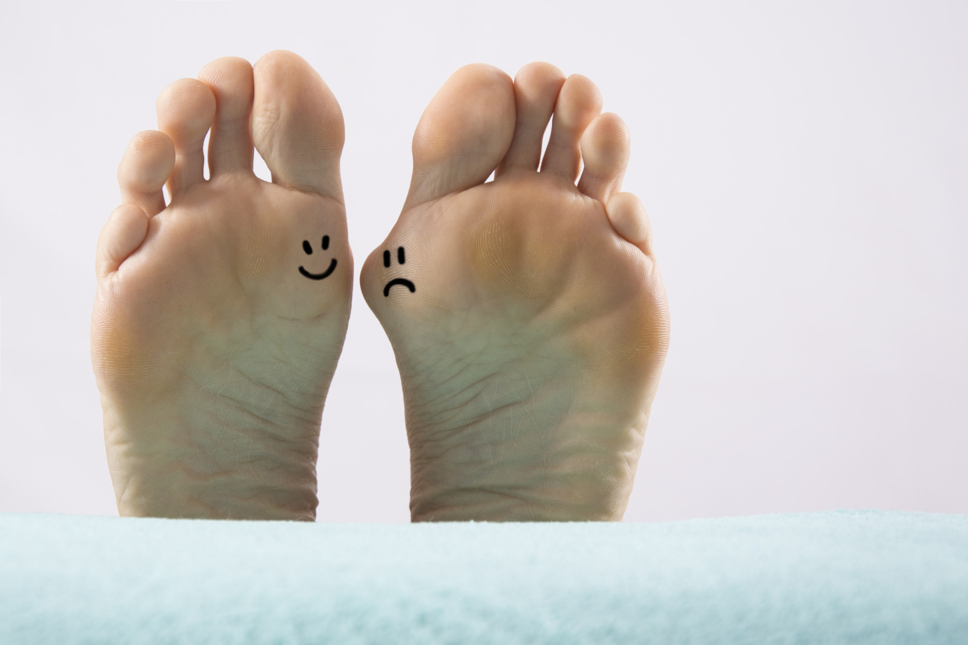 What causes bunions, and how can you get rid of them?