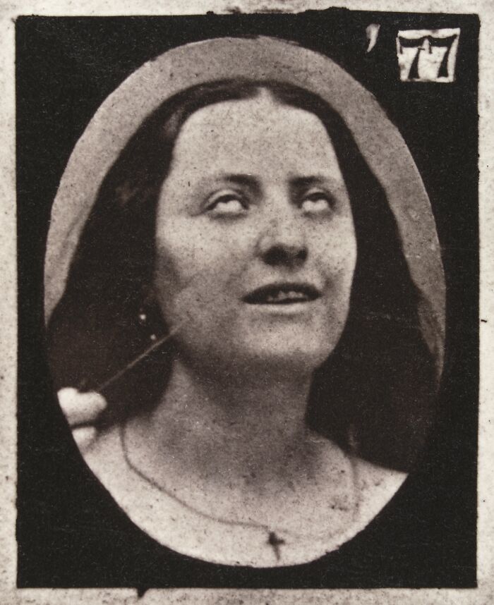 37 Creepy Photographs Of Facial Expressions That Were Part Of A 19th ...