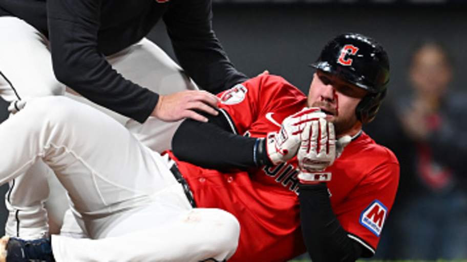 Guardians' David Fry Won't Need Surgery After Fouling Ball Off His Face ...