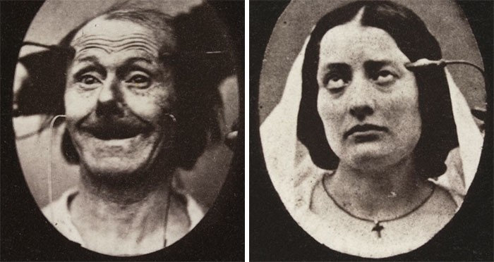 37 Creepy Photographs Of Facial Expressions That Were Part Of A 19th ...