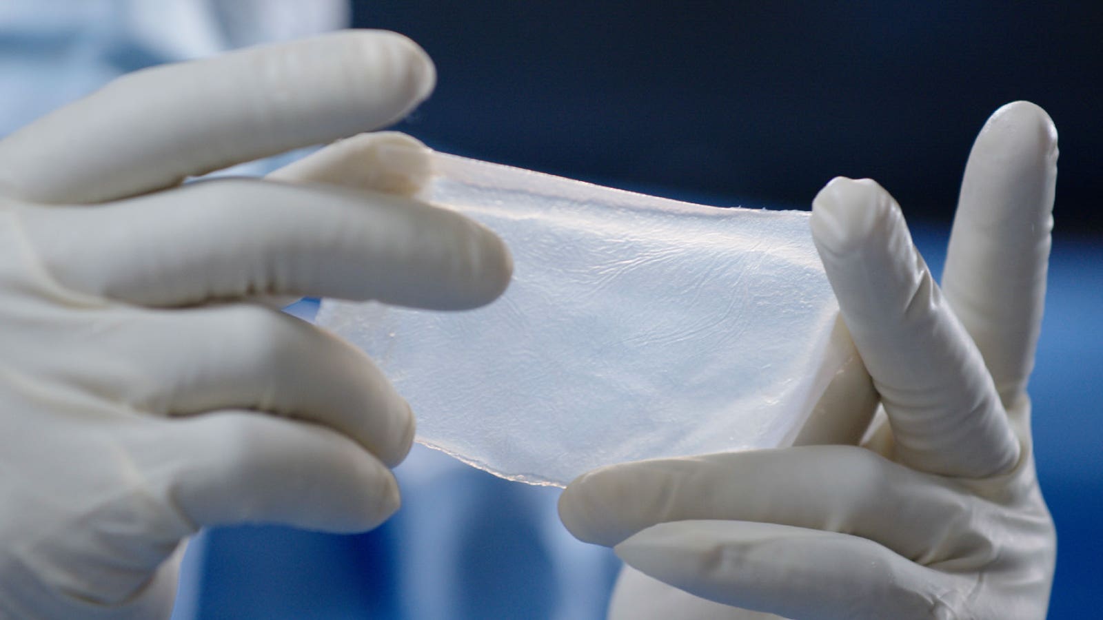 HHS Watchdog Calls Out Fraud and Abuse in Skin Substitute Market