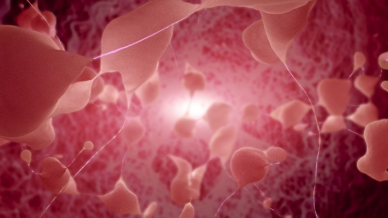 Huntington’s disease successfully treated in 1st major breakthrough