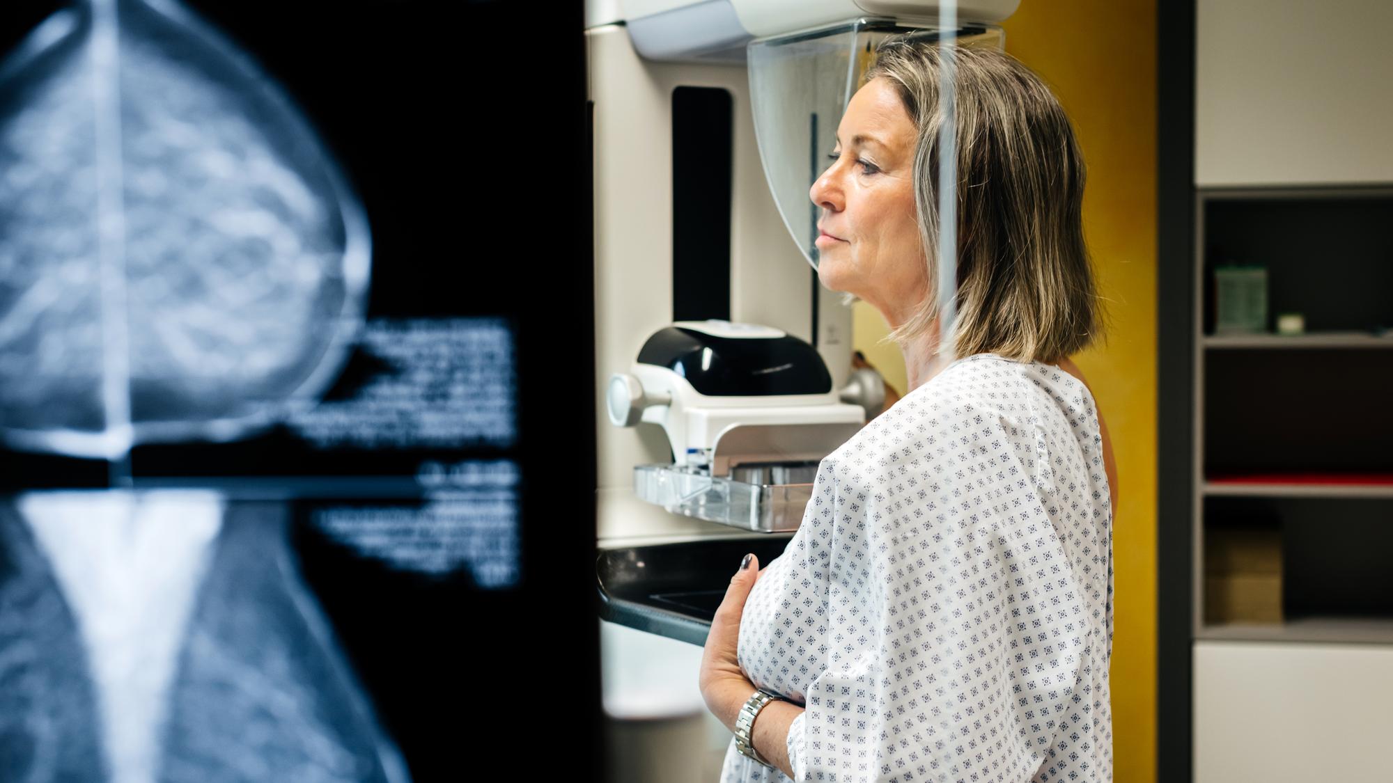 Cancer : Une étude révèle comment les inégalités sociales impactent les ...