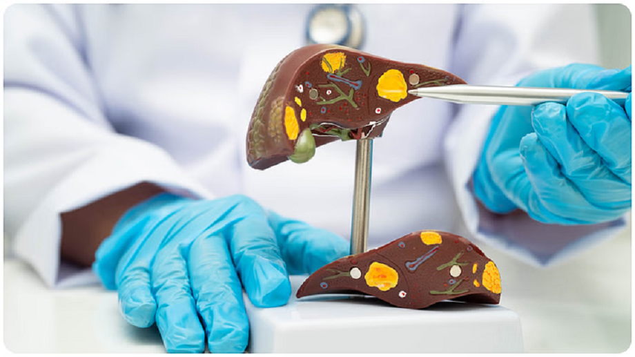 Liver Detox: These four inexpensive fruits will remove dirt stuck to ...