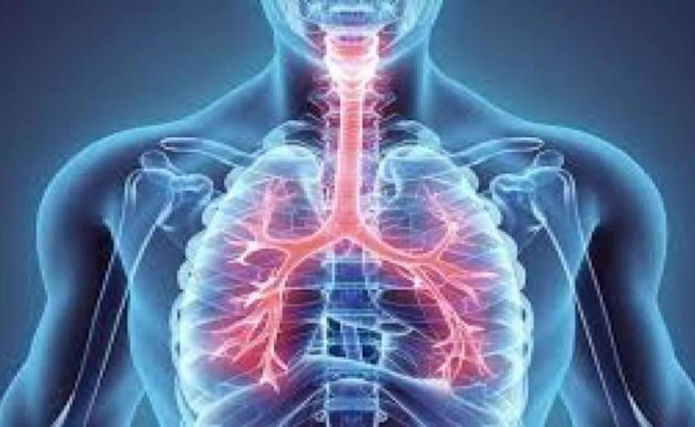 Expert Busts Common Myths About Lung Cancer