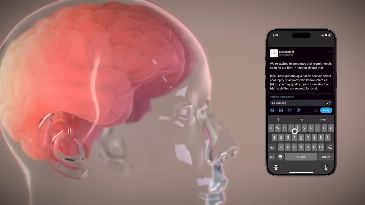 Everything about Neuralink you need to know