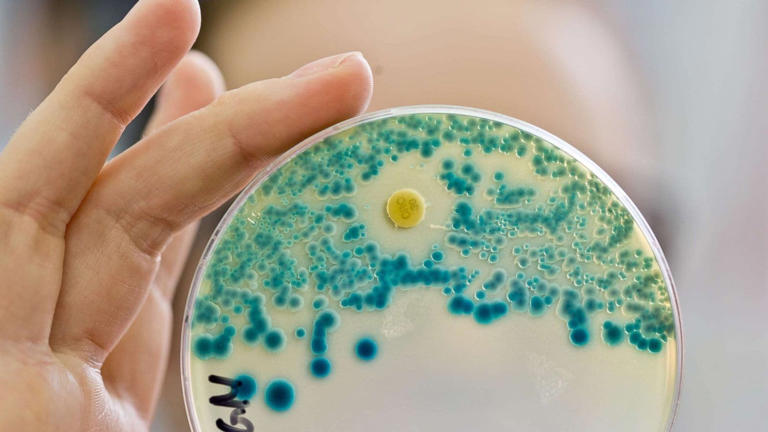What are ‘nightmare bacteria’ and why is this infection surging in US?