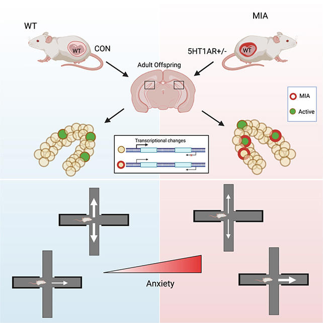 Roots of Your Anxiety May Trace Back to a Time Before You Were Born