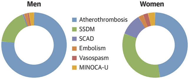 Over 50% of heart attacks in younger women aren't from clogged arteries