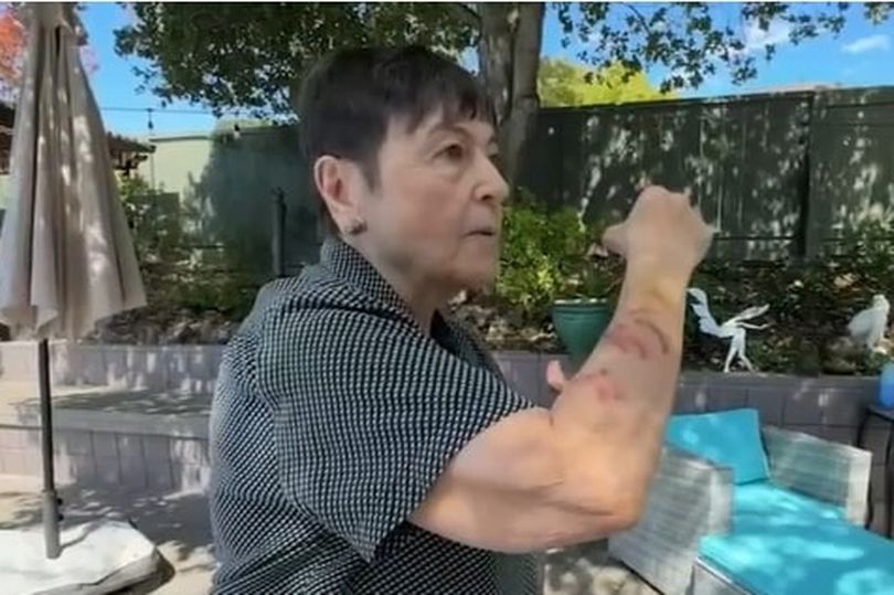 Vicious squirrel puts two in HOSPITAL as terrified neighbourhood on ...