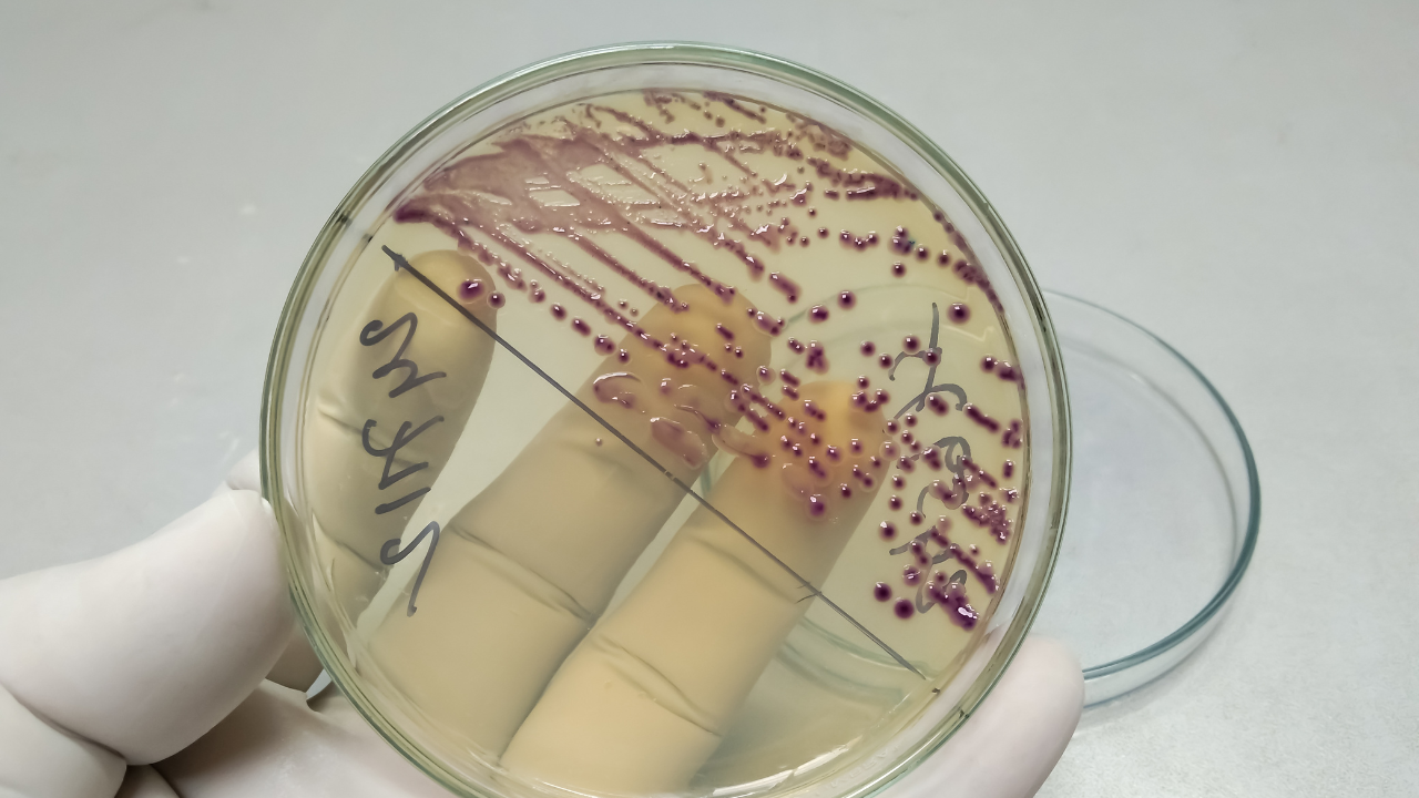 Fever, pain, dysuria: Can it be UTI? How to detect it at home