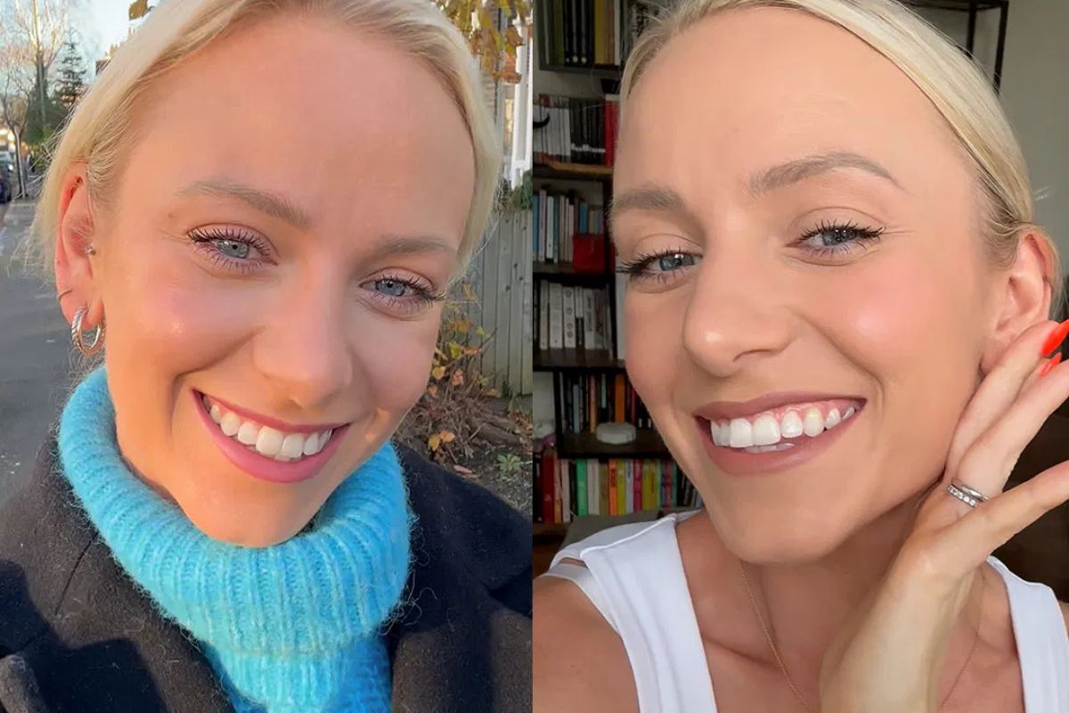 This beauty treatment promises to get you a holiday-ready smile ready ...