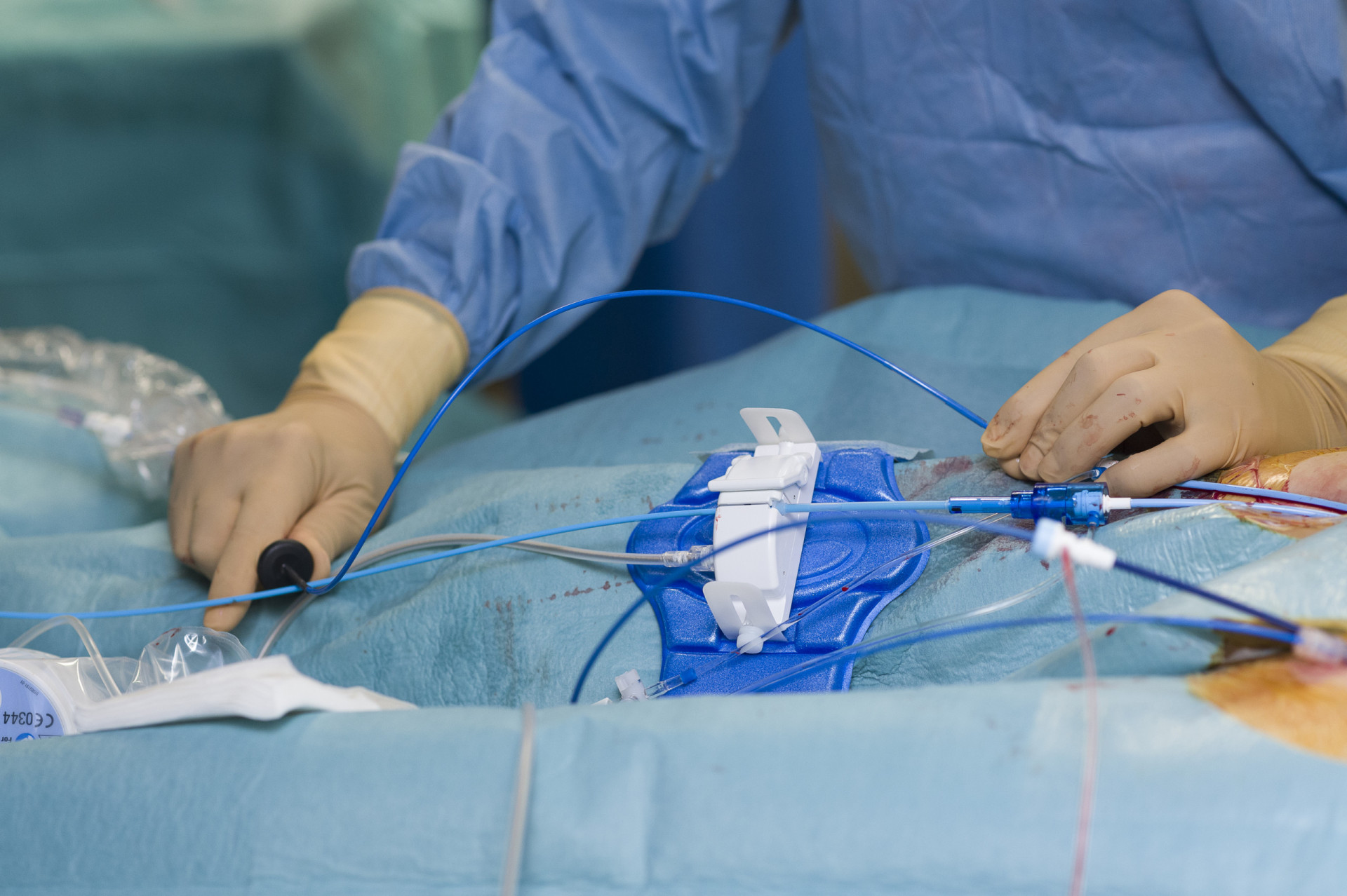 What exactly is postural orthostatic tachycardia syndrome?