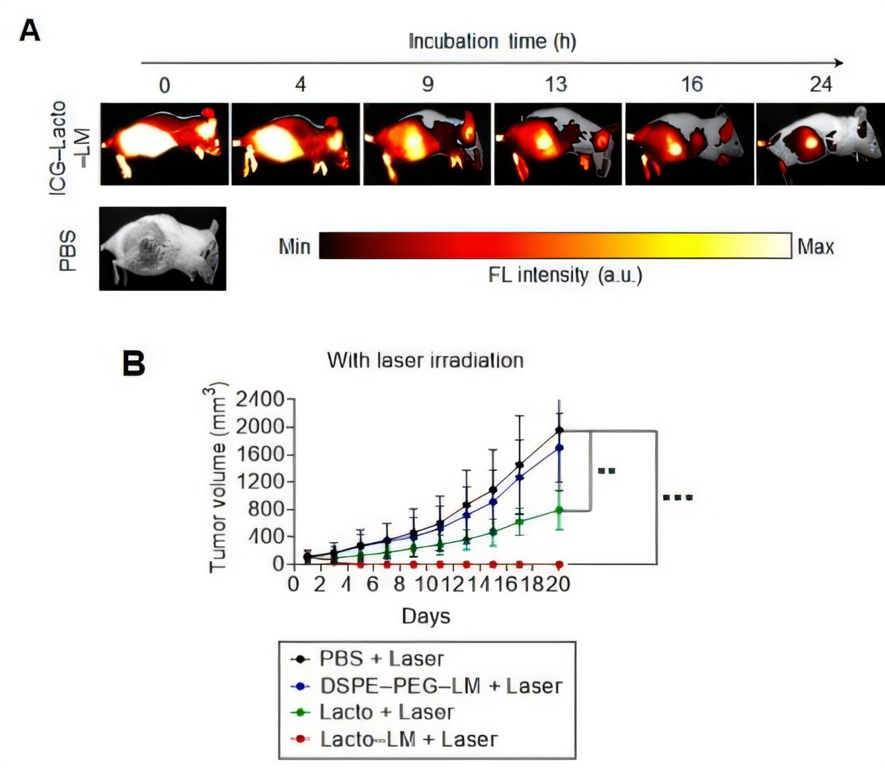 Multifunctional liquid metal nanocomposites for cancer ...