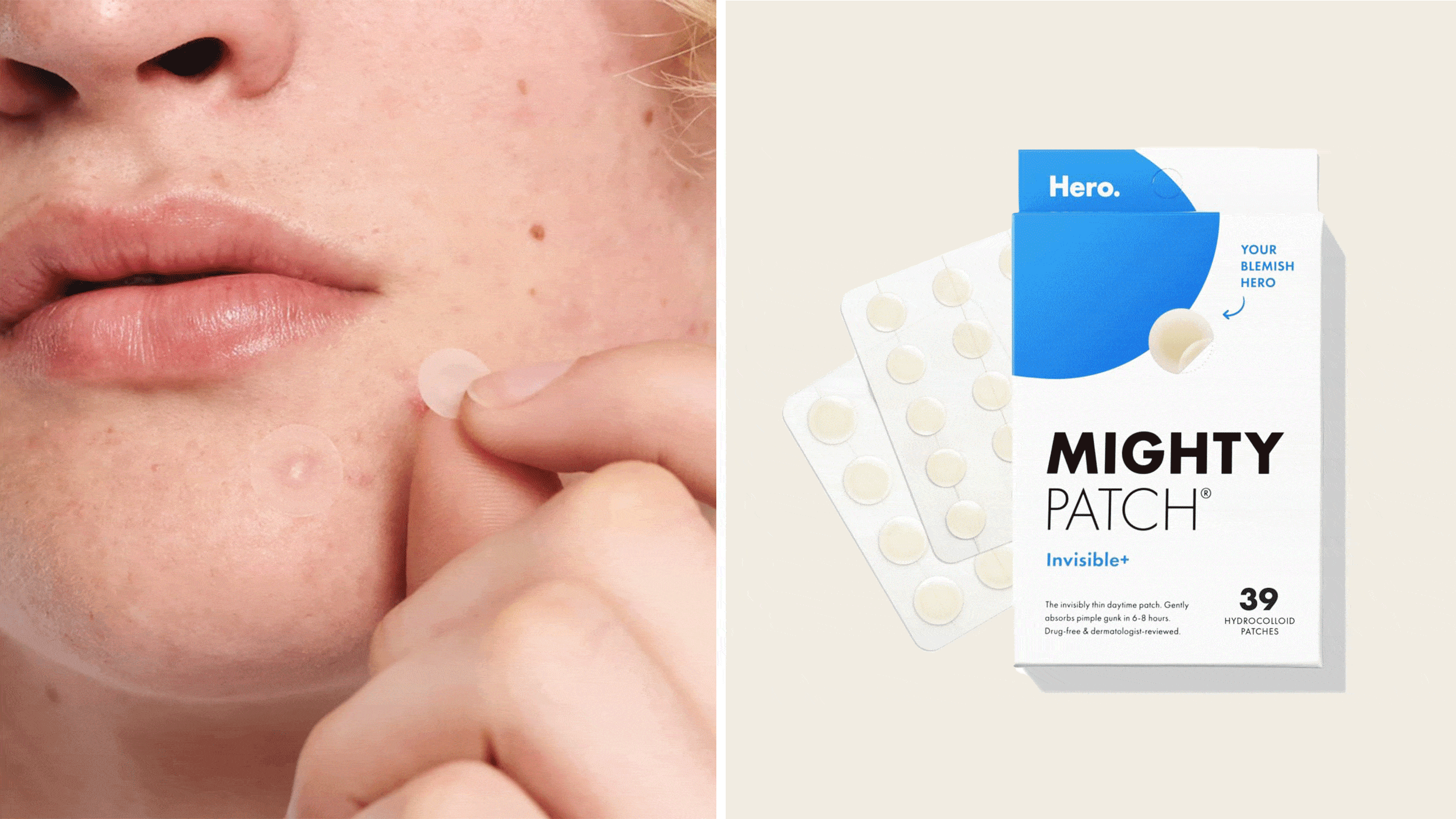 10 Pimple Patches to Shrink Zits Down to Size, According to Skin Experts