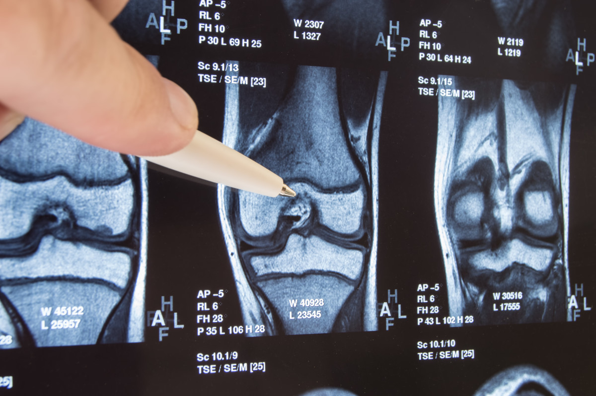 I'm an Orthopedic Surgeon. Here are 3 Everyday Risks I'd Never Take