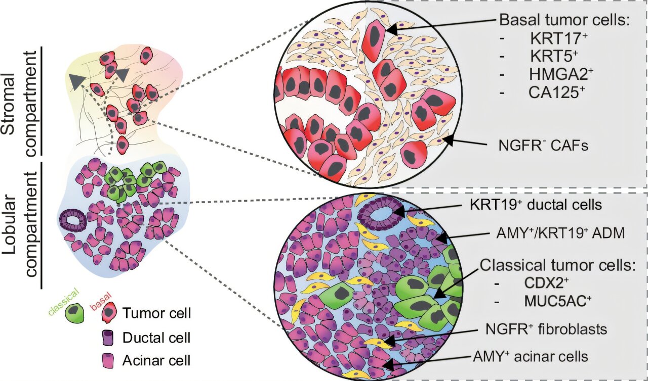 Tumor cells can exploit damaged tissue in the pancreas to create new ...