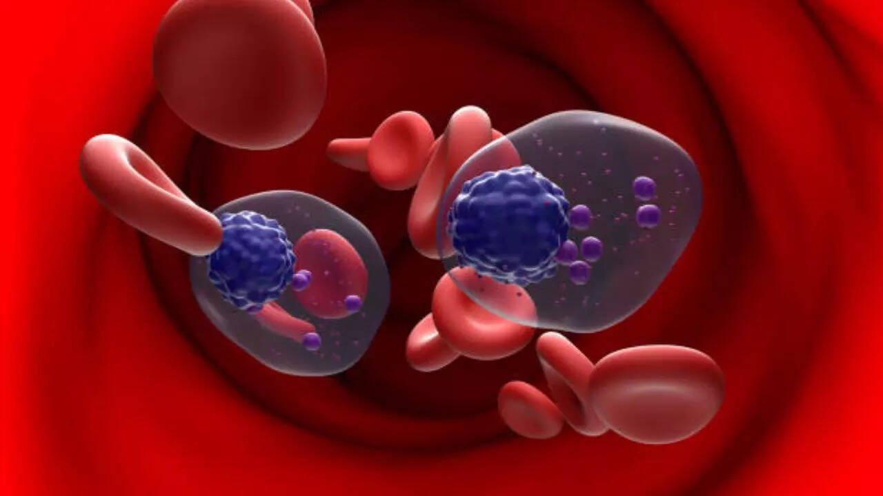 What is Myeloma? British woman diagnosed with a rare blood cancer that ...